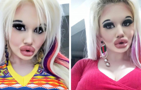 La influencer con los labios más gruesos del mundo